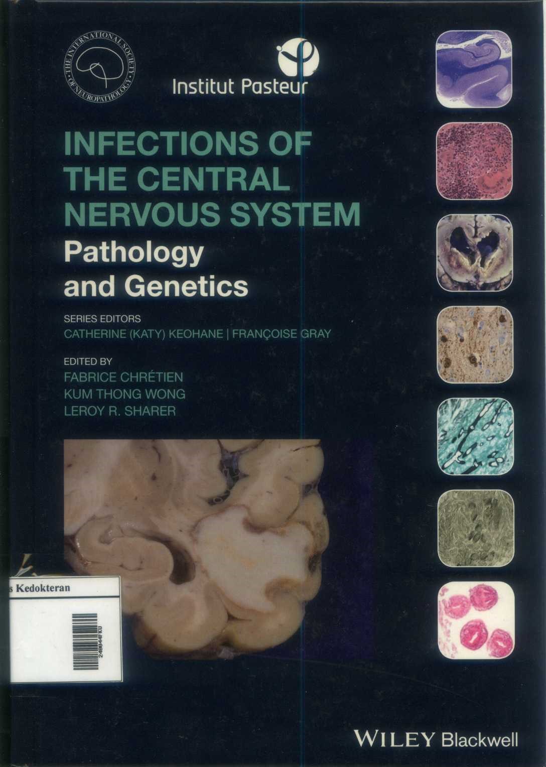 Infections of the Central Nervous System: Pathology and Genetics ...